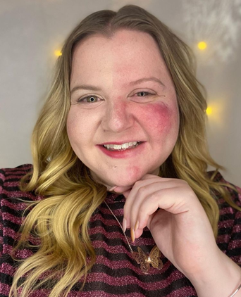 Beth: Self-Acceptance is a Journey, not an Image. - Cassandra Bankson